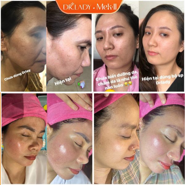 Dr Lady | Mỹ phẩm từ Thiên Nhiên An Toàn, Uy Tín